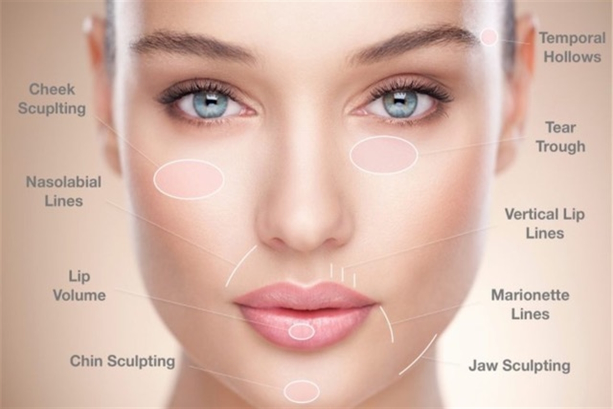 Chin/Jaw Filler Treatment - Azita Academy